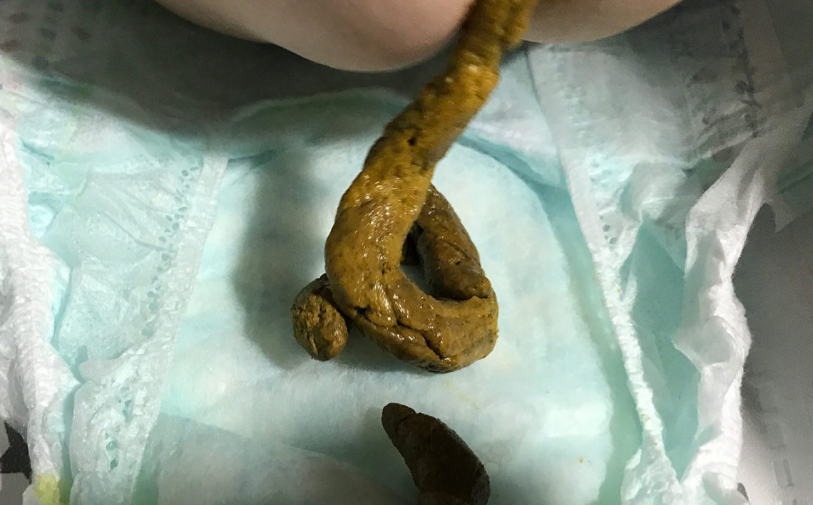 Limpia cacas de bebé a todas horas (versión con fotos y detalles ...